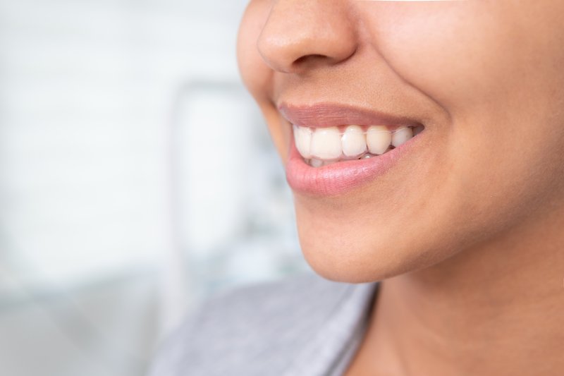 Can I Get Invisalign After Braces | Dr. Alex Johnson Orthodontics